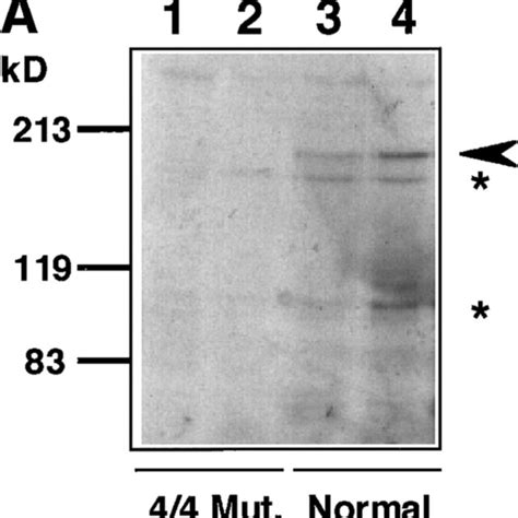 Comparison Of Levels Of Wrn Helicase Expression In Cells Of Normal Download Scientific Diagram
