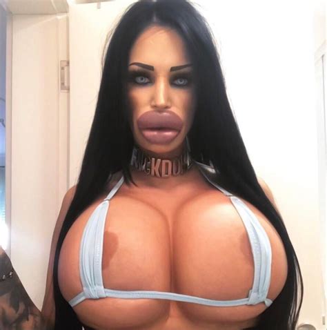 Where Did It All Go Wrong R Botchedsurgeries