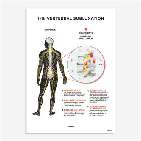 Vertebral Subluxation Poster By Kirografiks