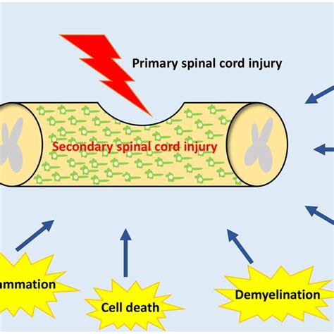 Of Secondary Injury Processes Following Tsci Download Scientific Diagram
