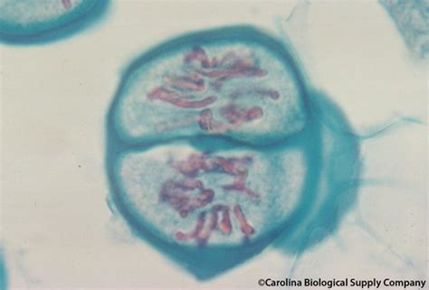 Mitosis Stages Including Micrographs Flashcards Quizlet