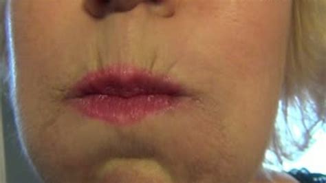 Puffy Cheeks Breath Hold Katy Noelle Clips Sale