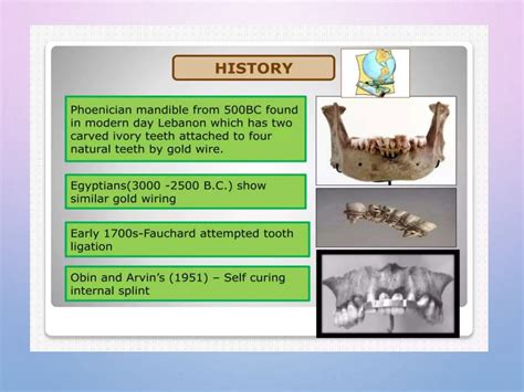 Splinting Materials And Techniques Finalpptx