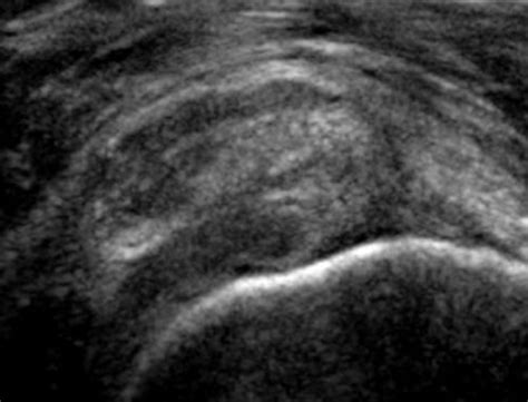 Basic Pathology Concepts Flashcards Quizlet