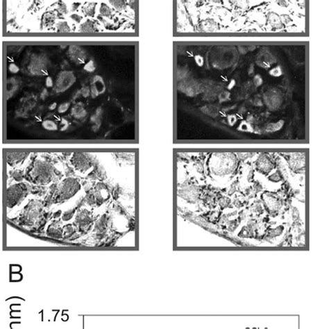 Coexpression Of Functional Ccr1 And Mor On Drg Neurons A
