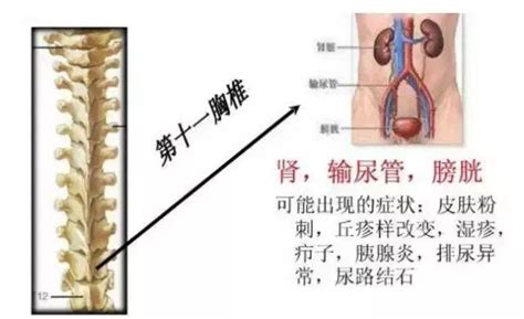 脊柱引起的108种疾病大全 知乎