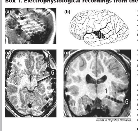 Structure Of Superior Temporal Sulcus Semantic Scholar