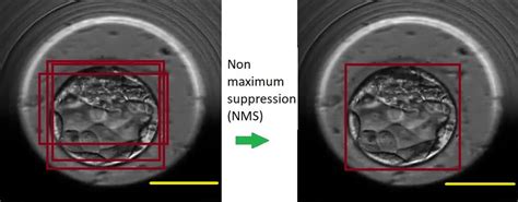 Yolo V5 Detects Three Bounding Boxes For The Morula Stage The Bounding