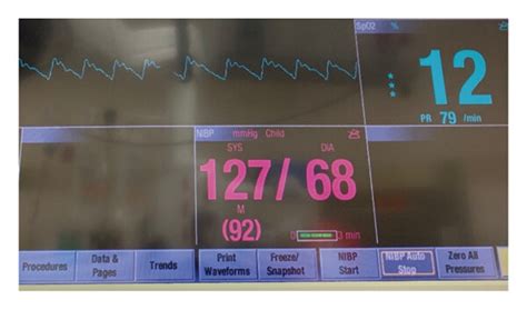 A Standard Pulse Oximetry Reading On Room Air Download Scientific Diagram