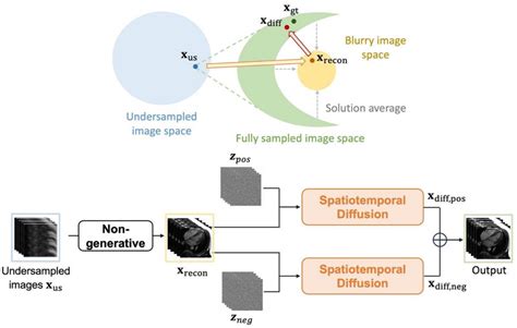 논문 리뷰 Spatiotemporal Diffusion Model With Paired Sampling For Accelerated Cardiac Cine Mri