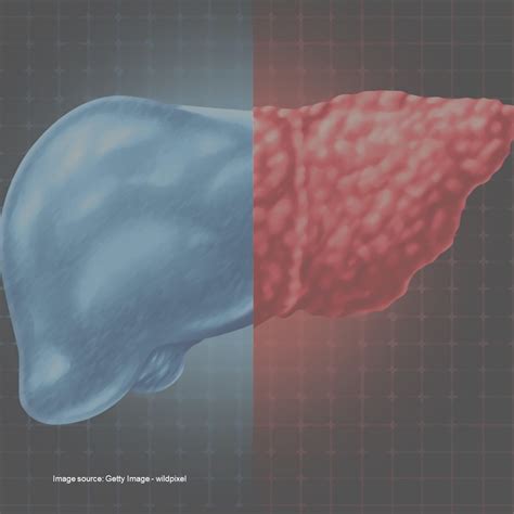 Rezdiffra Swot Analysis And Strategic Evaluation Atacana Group