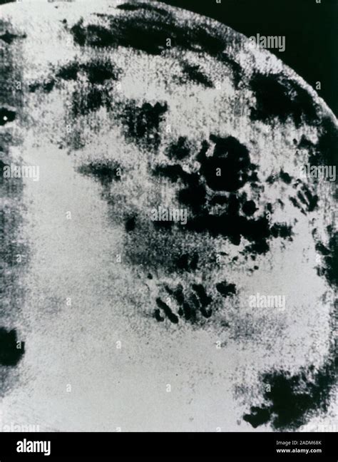 First Image Of The Far Side Of The Moon The First Image Returned By