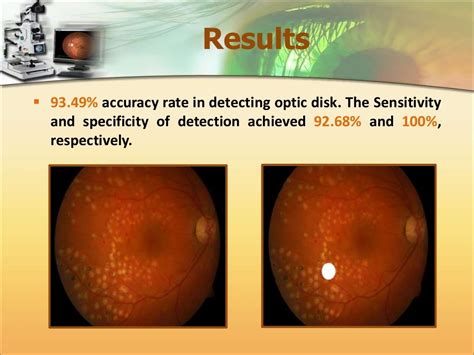 automatic detection of diabetic maculopathy from fundus images using