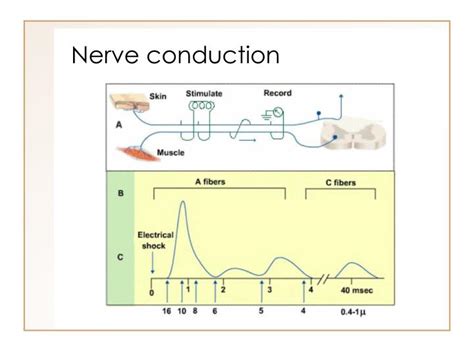 Conduction Block Sensory Nerve At Sara Mccall Blog