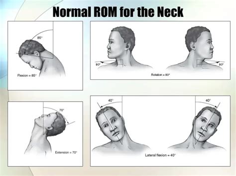 Cervical Flexion Exercises Physical Therapy Treatment And Exercise