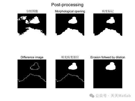 【图像分割】基于区域增长算法实现乳腺超声 Bus 图像分割附matlab代码基于区域增长的图像分割算法matlab Csdn博客