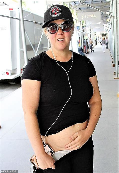 Amy Schumer Proudly Displays Her C Section Scar On New York City Street Daily Mail Online
