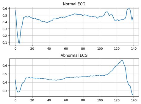 오토인코더를 이용한 이상탐지 Anomaly Detection with AutoEncoder DONGJUS BLOG