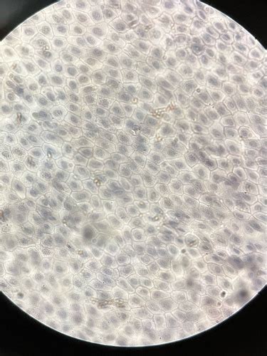 Lab Practicum 3 Picture Match Flashcards Quizlet Lab Practicum 3 Picture Match Flashcards Quizlet