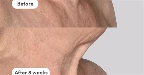 Magic £68 Trinny Londons The Elevator Visibly Smooths Neck Lines