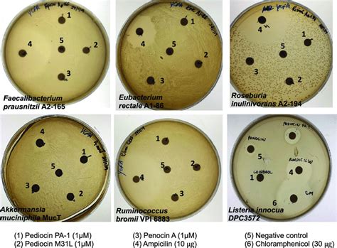The Effect Of Pediocin Pa 1 Pediocin M31l And Penocin A On Human Gut