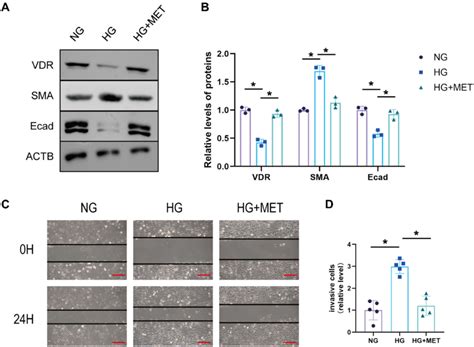 Metformin Ameliorates Vdr Expression And Emt In The Hk 2 Cell Model Of
