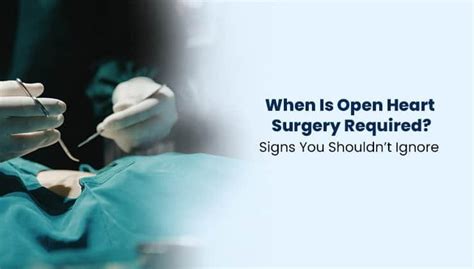 Open Heart Surgery Vs Bypass Surgery A Comprehensive Guide