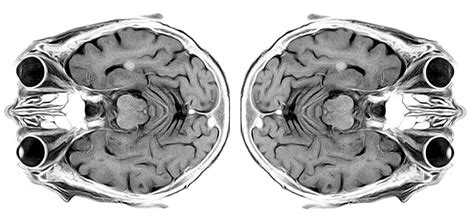 Intro To Analyzing Brain Imaging Data— Part I Fmri Data Structure By