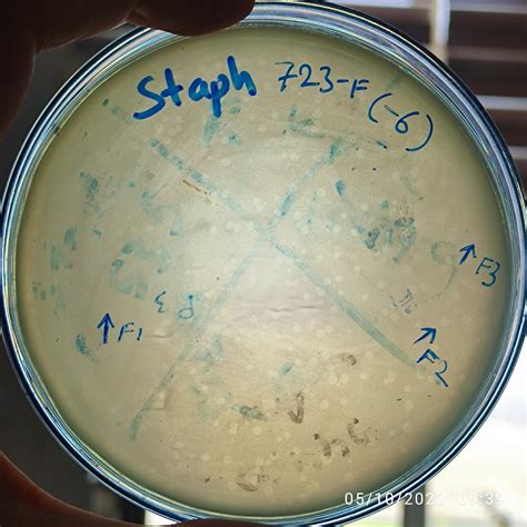 Staphylococcus Aureus Bacteriophage 152723f Mikroliz