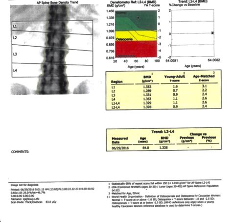 Bone Densitometry River Radiology