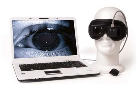 How Much Does A Vng Test Cost