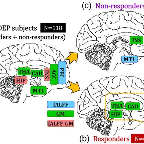 Ect Treatment Responsive Multimodal Brain Networks For A All Dep Download Scientific Diagram