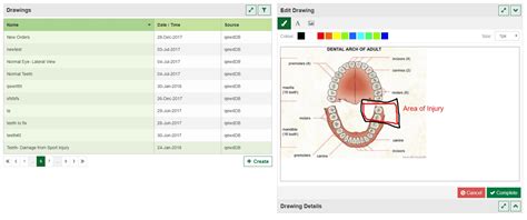 Drawings Module Pulsetile