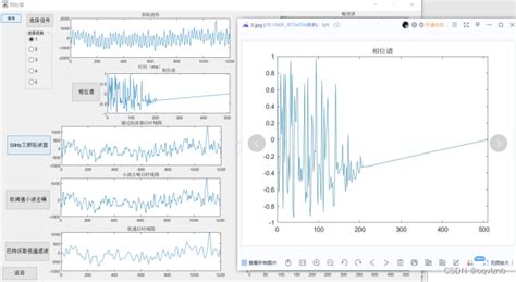 脑电信号处理系统设计及 Matlab 实现matlab脑电信号处理gui界面、去噪、提取波段、频域分析、滤波、分类检测 1脑电 Csdn博客