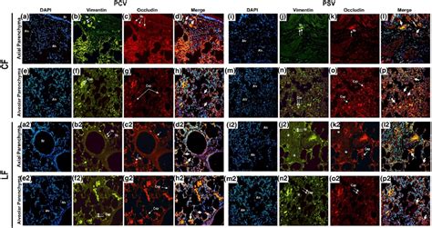 Immunofluorescence Of Occludin And Vimentin Histologic Sections ×400 Download Scientific