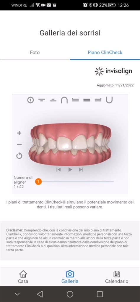 What Do You Think About Clincheck 🙃 R Invisalign