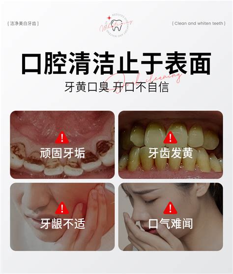 牙匠师介孔羟基磷灰石吸色精华改善口腔呵护牙龈净渍美白清新口气 阿里巴巴