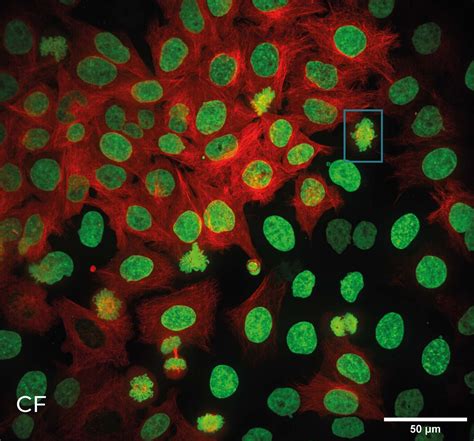 Live Cells Details And Dynamics With Structured Illumination Microscopy