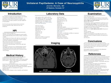 Pdf 3rd Annual Resident And Fellow University Of Rochester · Diagnosis Of Unilateral