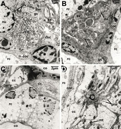 Transmission Electron Micrographs Tem Showing Fine Structural Details Download Scientific