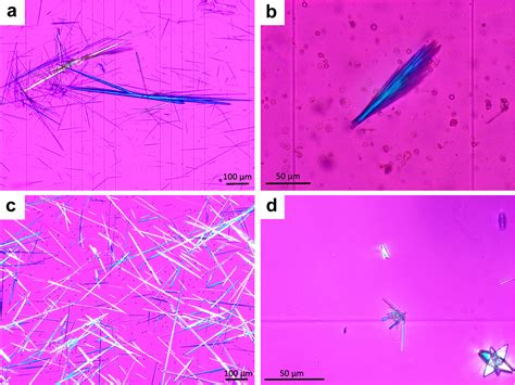 Amoxicillin Crystalluria And Amoxicillin Induced Crystal Nephropathy A