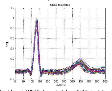 Figure 5 From Automated Ecg Segmentation Using Piecewise Derivative Dynamic Time Warping