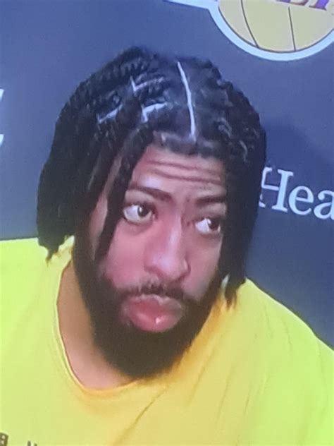 Did Ad Shave The Unibrow R Lakers
