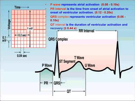 Basic Dysrhythmia Interpretation Pptx