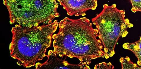 223 Wksp Gene Regulation Whats New Hsls Molbio