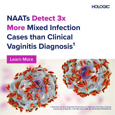 Aptima® Vaginal Health Hologic Inc