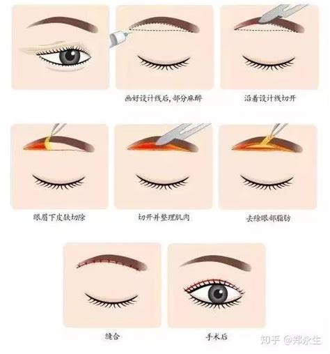 年龄可以衰老，眼睛不可以 知乎