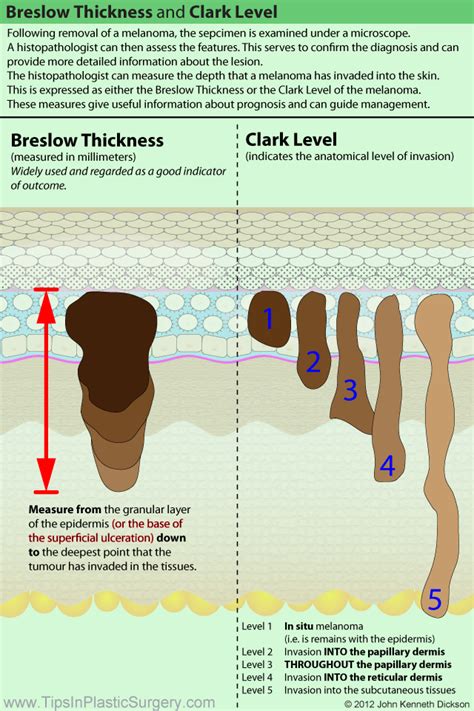 Skin Tipsinplasticsurgery