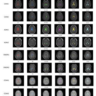 Prediction Examples SS Only GS SS SS GS Models Trained On 100 SS Masks Download Scientific