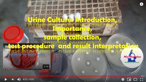 Urine Culture Introduction Importance Sample Collection Test Procedure